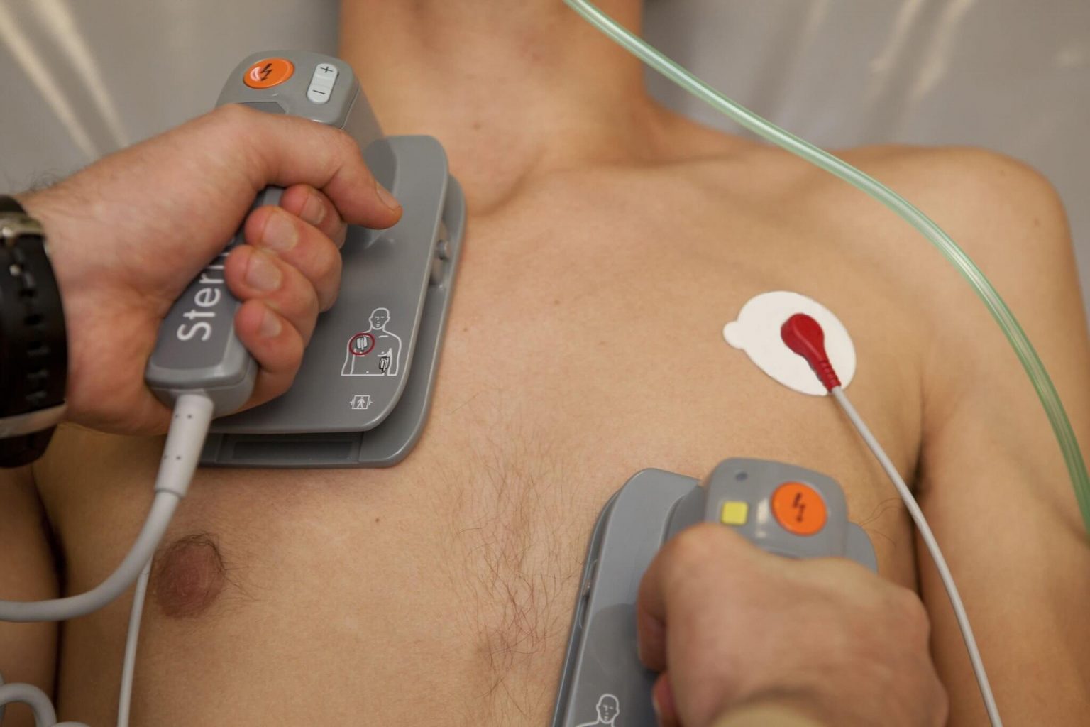 Discover 4 Key Differences Between Defibrillator VS Cardioversion